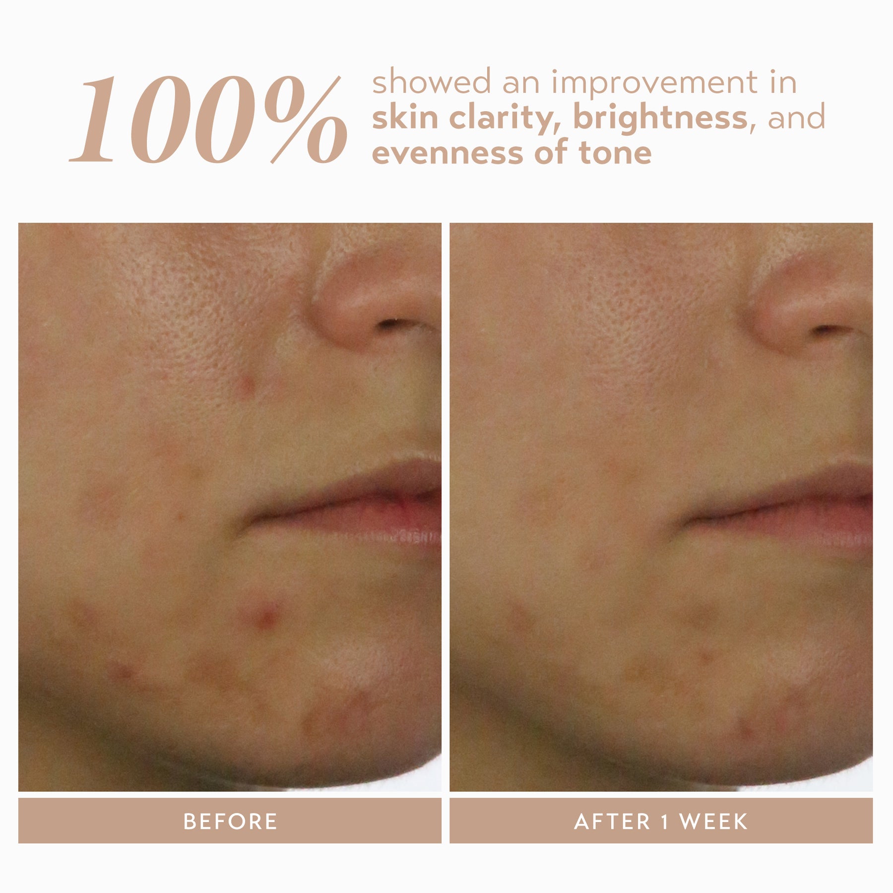 Rescue Serum | Shani Darden – Shani Darden Skin Care